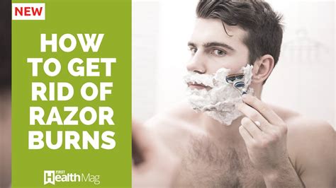 How To Get Rid Of Razor Bumps And Burns Naturally Youtube