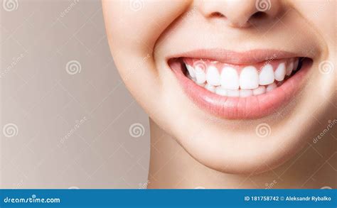 Perfect Healthy Teeth Smile Of A Young Woman Teeth Whitening Dental