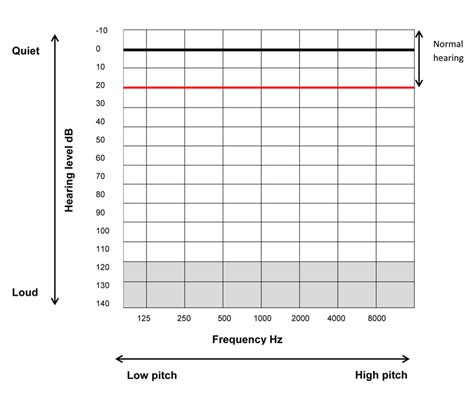 what is a hearing test hearing link