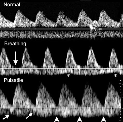 A Radiologists Guide To The Performance And Interpretation Of