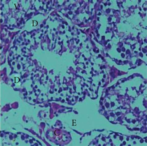 Light Micrographs Of Testicular Tissues Of The Experimental Groups