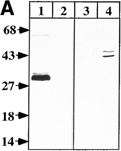 Trim Associates With The Tcr Cd3 ζ Complex At The Cell Membrane A