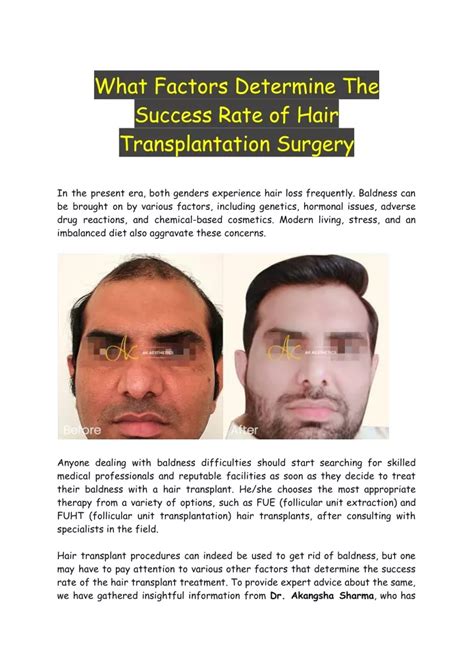 Ppt What Factors Determine The Success Rate Of Hair Transplantation