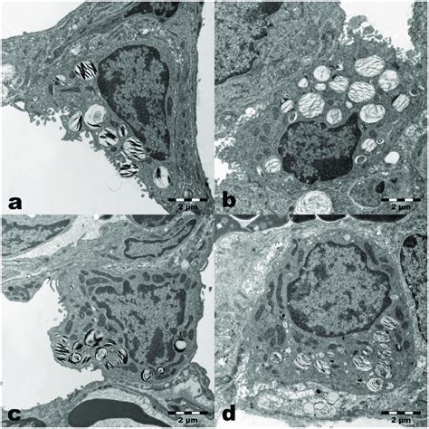 Ultrastructure Of Alveolar Epithelial Cells Type Ii Aeii A Control