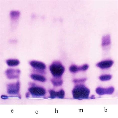 Tissue Distribution Of Ldh Isozymes Of O Niloticus L Liver E Eye