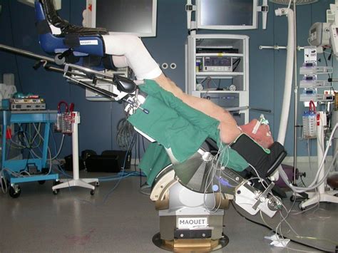 Robotic Sacrocolpopexy Olv