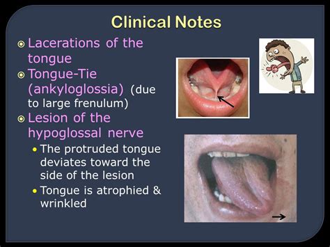 Oral Cavity Tongue And Palate Ppt Video Online Download