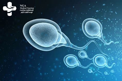 تحليل السائل المنوي للرجل طرق الفحص وكيفية قراءة النتائج
