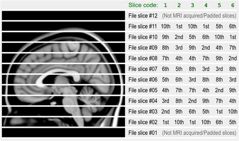 ct scan file extension ct scan machine