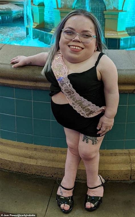 Three Foot Tall Woman With Rare Form Of Dwarfism Working As Fashion