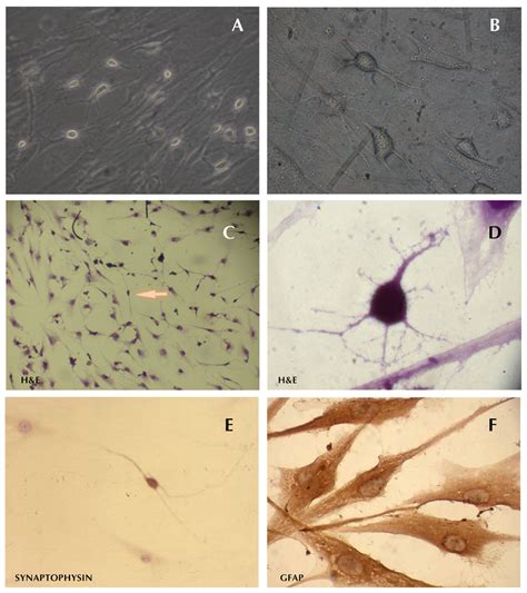 Neural Differentiation A Phase Image Of Stromal Differentiated