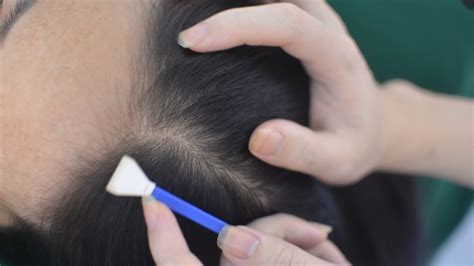 Asmr Hair Parting No Talking Real Person Scalp Scratch Scalp Massage