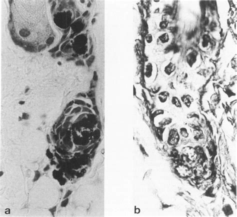 Cyp Dex Rapid Induction Of Dystrophic Telogen Follicles Tbis Figure