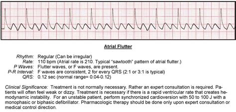 aflutter atrial flutter