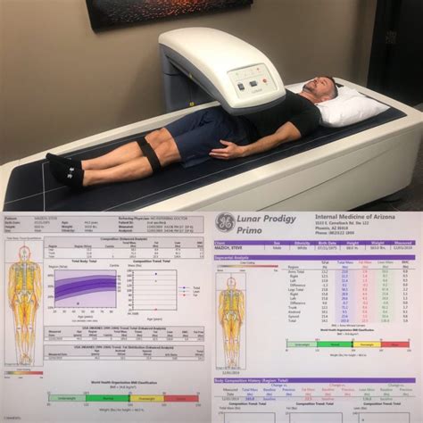 Dxa Body Composition Analysis Internal Medicine Of Arizona
