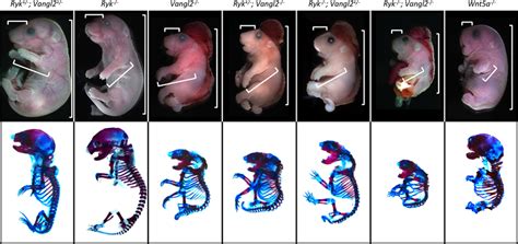 Genetic Interaction Of Ryk And Vangl2 Lateral Views Of E18 5 Mouse