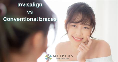 2024 Invisalign Vs Conventional Braces Which Is Right For You