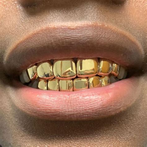 Gold Grillz Jackson Ms At Vincent Flippen Blog
