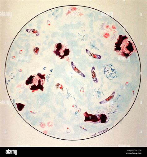 Malaria Parasite Illustration Of The Malarial Parasite Plasmodium
