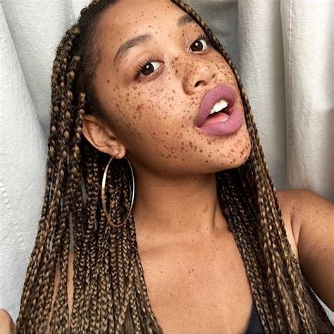 Freckle Girl With Braids Porn Videos Newest Girl With Freckles And