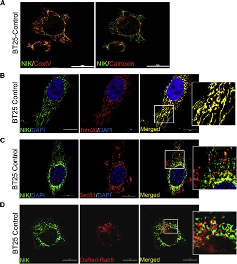 Nik Map3k14 Regulates Mitochondrial Dynamics And Trafficking To Promote