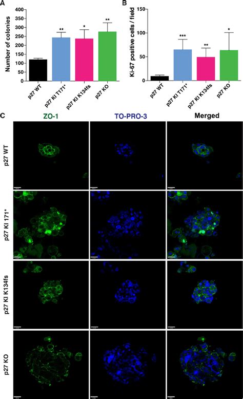 Loss Of Cdkn1b And Expression Of C Terminal Deletion Mutants Alter The