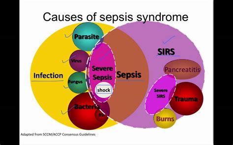Sepsis Schematic