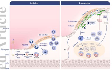 Initiation And Progression Of An Atherosclerotic Lesion Left Panel