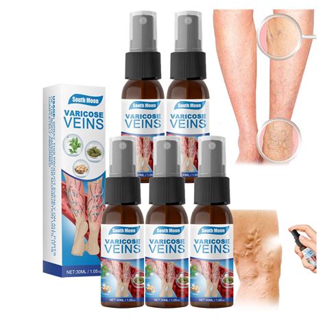 Varicose Veins Treatment Spray Veinhealing Varicose Veins Spray Vein