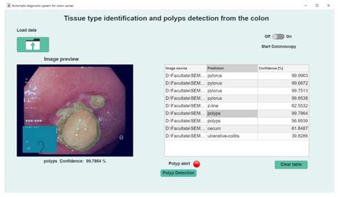 Sensors Free Full Text Automatic Detection Of Colorectal Polyps