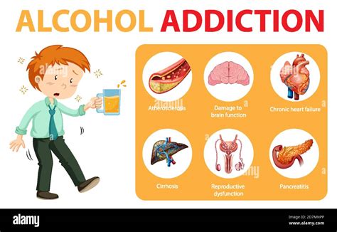 Alcohol Addiction Or Alcoholism Information Infographic Illustration