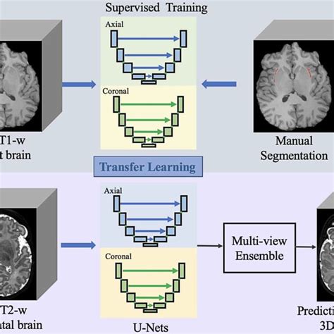 A Schematic View Of The Proposed Segmentation Method Using Transfer
