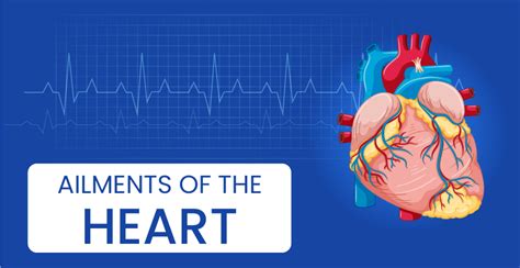 Six Most Common Heart Diseases In The Modern Era Mrmed