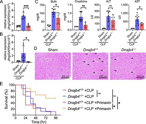 Hlj1 Amplifies Endotoxin Induced Sepsis Severity By Promoting Il 12