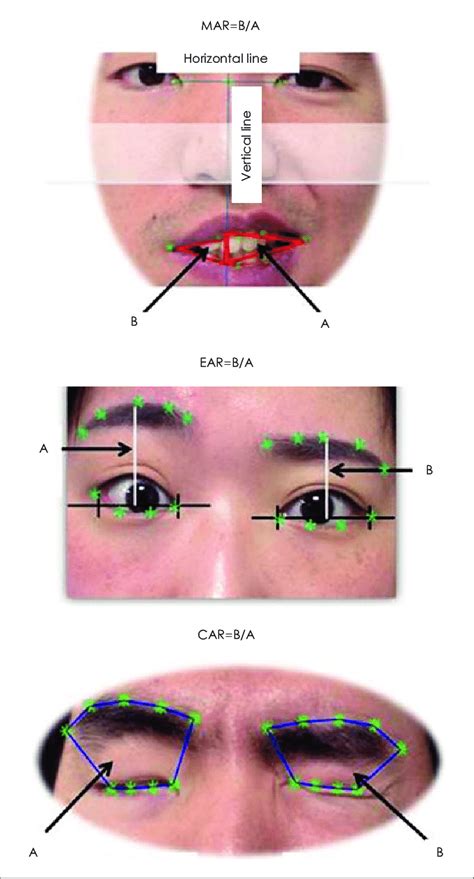 Summary Of Pc Based Facial Asymmetry Assessment Program Scaling