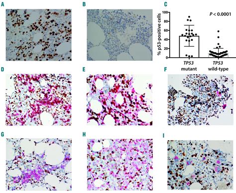 Tp53 Immunohistochemistry Correlates With Tp53 Mutation Status And