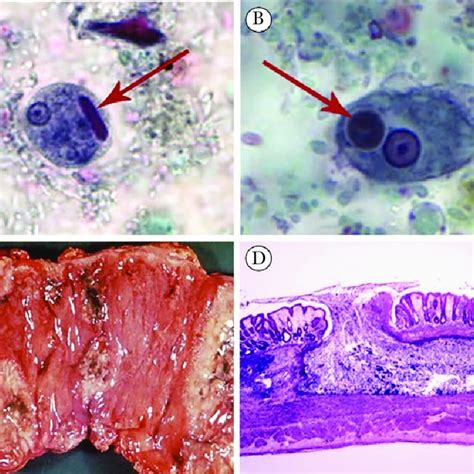 Pdf A Good Review Of Amebiasis Includes Epidemiology Diagnosis And