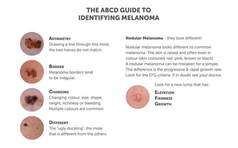 Melanoma Symptoms Detection And Treatment Utah Valley Dermatology