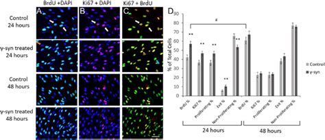 Immunocytochemistry Analysis Of Brdu Ki67 And Dapi Colocalization