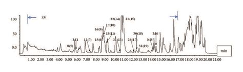 Total Ion Flow Diagram Of Ftz Ftz Serum By Uplc Esi Ms Analysis The