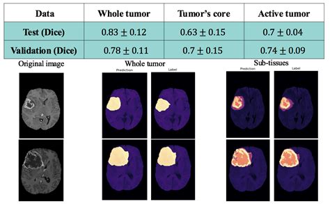 github royhirsch braintumorsegmentation final bsc