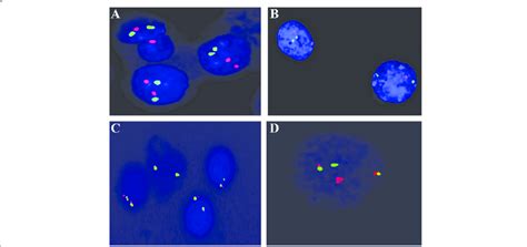 Representative Of Fluorescence Images In Situ Hybridization A Normal