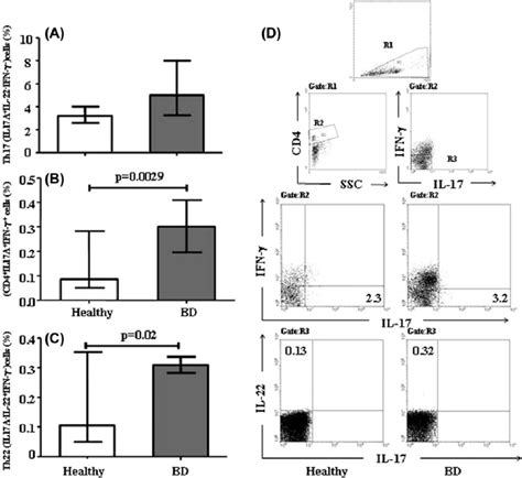 Increased Expression Of Th22 And Th17 Th1 Cell Subset In Cd4 T Cells