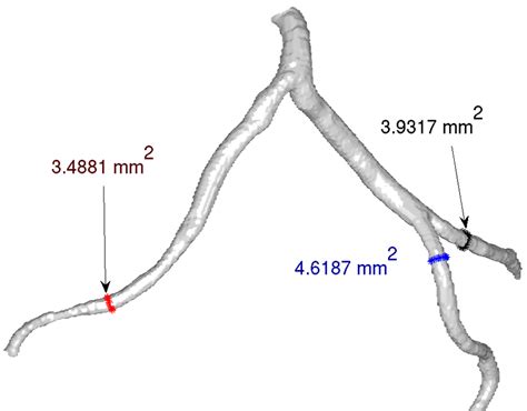 Cross Sectional Area Visualization Left The Cross Sectional Area Of