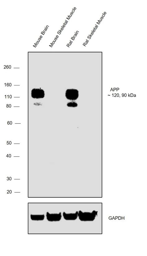 App Amyloid Precursor Protein Antibody 14 9749 82