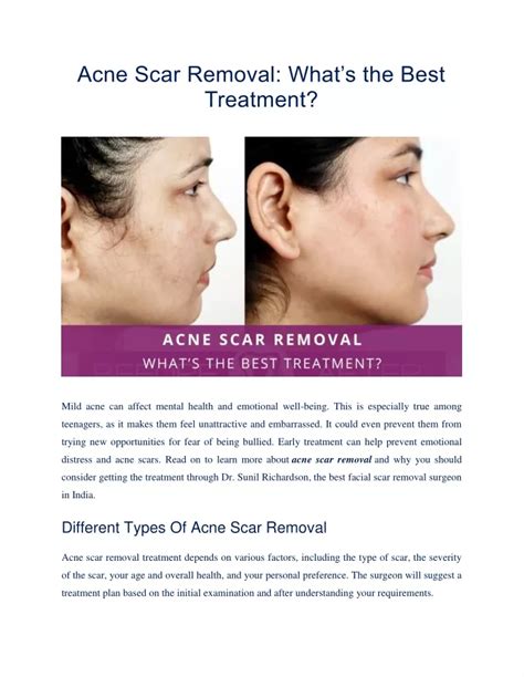 Ppt Acne Scar Removal Treatment Types Cost Recovery Powerpoint