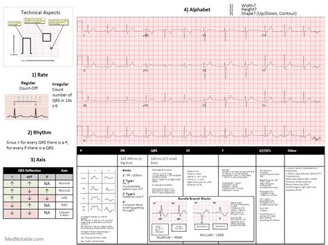 Free Printable Ekg Interpretation Cheat Sheet
