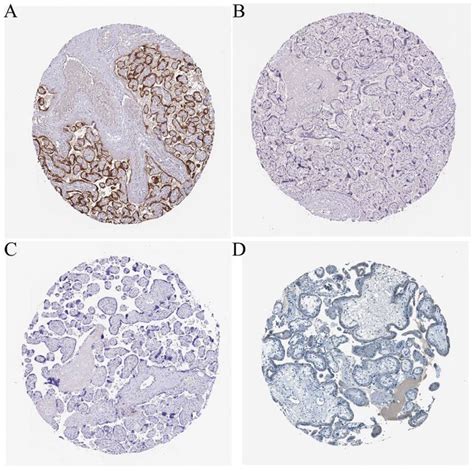 Protein Expression In Normal Placenta A Kiss1 B Prl C Tac3
