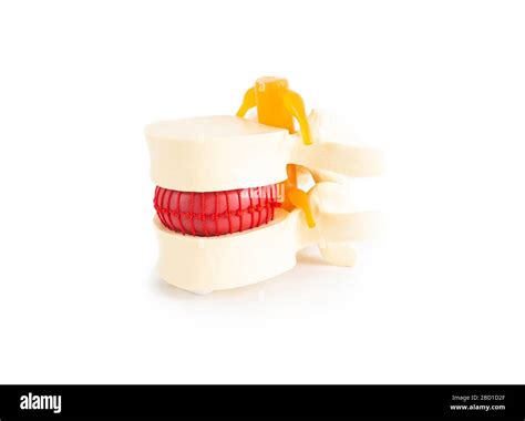 Spina Bifida Fotos Und Bildmaterial In Hoher Auflösung Alamy