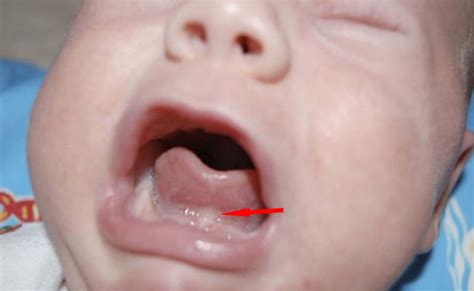 Thưởng Thức Hình ảnh Thắng Môi Trên Bình Thường Và Những Vẻ đẹp Khác